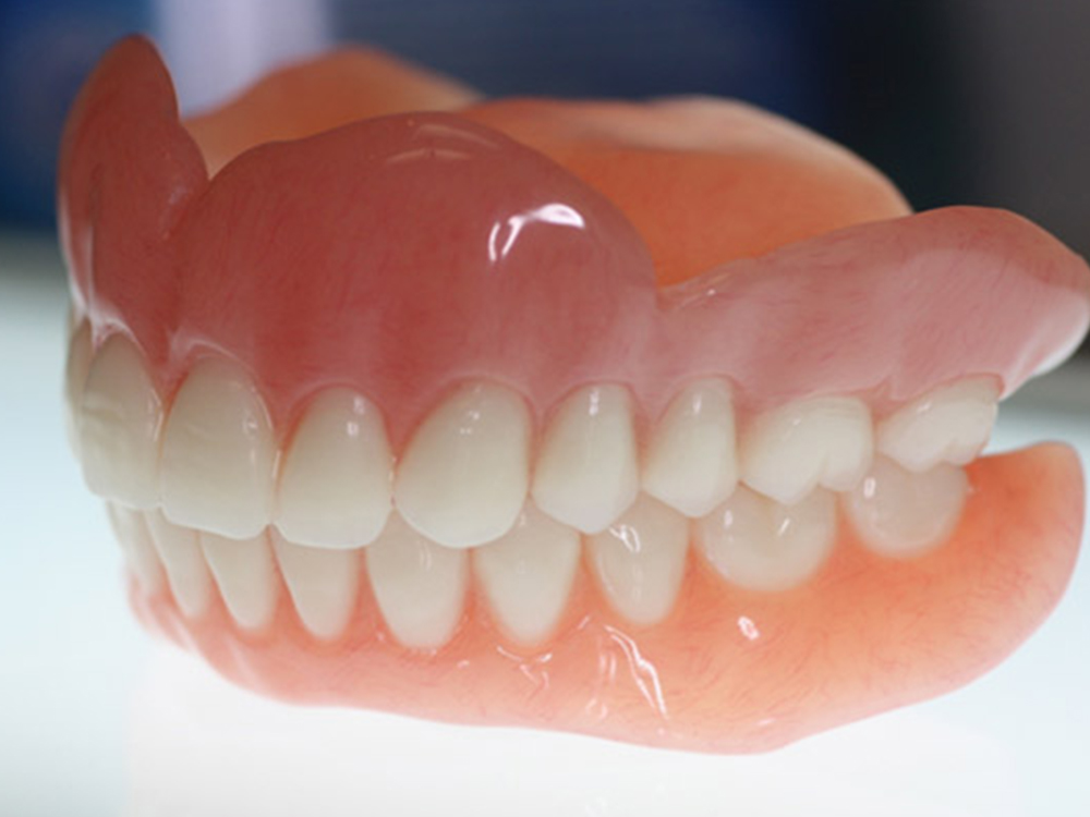 Prothesis - Dental Treatment in Turkey - Europe Dental Clinic
